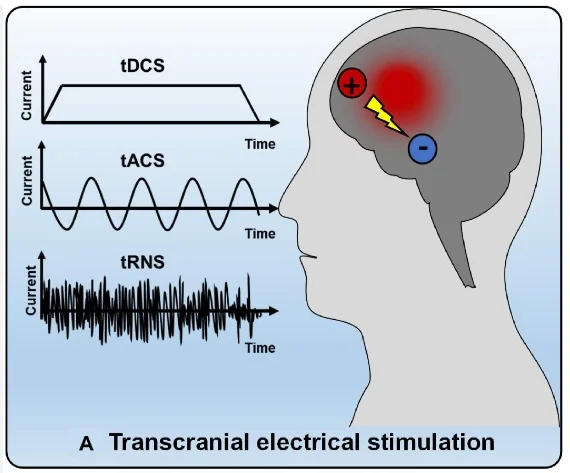 Transkraniyel alternan akım uyarımı – tACS - NeuroUp Clinic